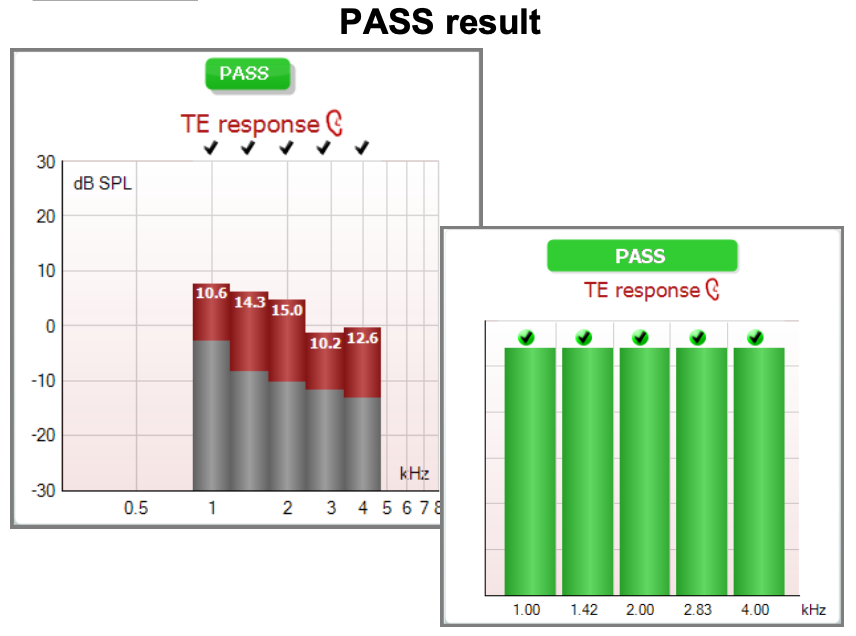 Titan | TEOAE PC | Interacoustics